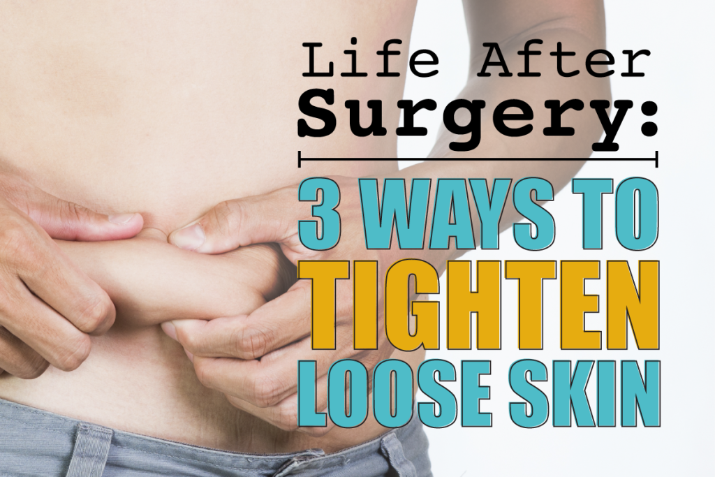 Life After Surgery: 3 Ways to Tighten Loose Skin | Dr. Steven Fass