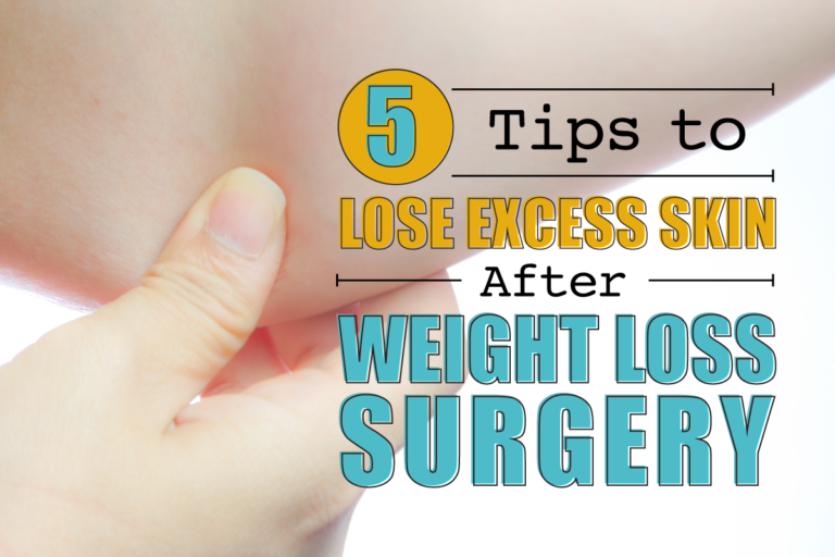 5 Tips to Shed Excess Skin after Weight Loss Surgery | Dr. Steven Fass